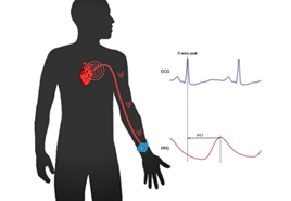 Tracking heart health with wearable devices | Swiss Re